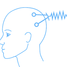 Основные обозначения на ЭЭГ — Step 14 — Stepik